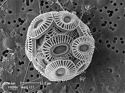 Interesting Algae Micro-Organisms on Electron Microscopy - Jeffrey Dach MD