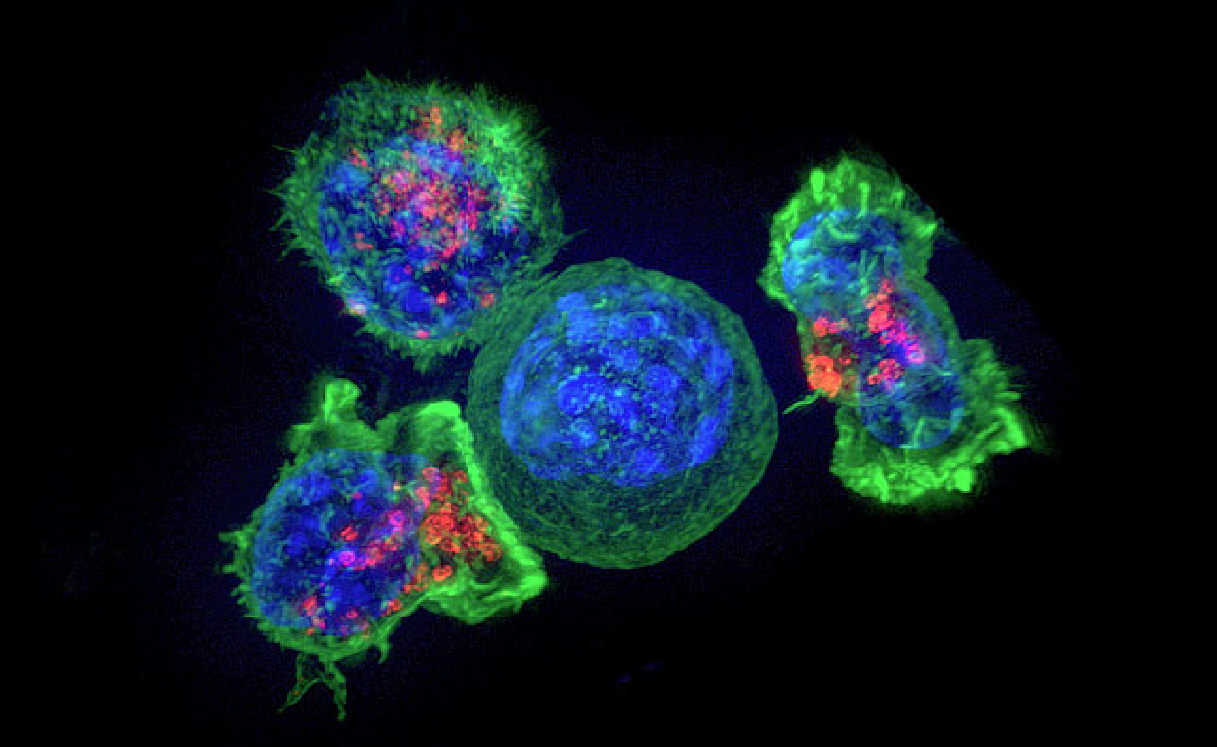 Paradoxical Pro-Metastatic Effects of Chemotherapy - Jeffrey Dach MD